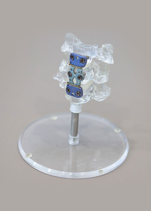 ACDF and ADR - SpineCare Singapore